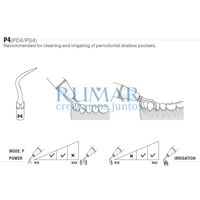 Woodpecker P4T ultrasonic tip, Perio, TITANIUM • RUMAR