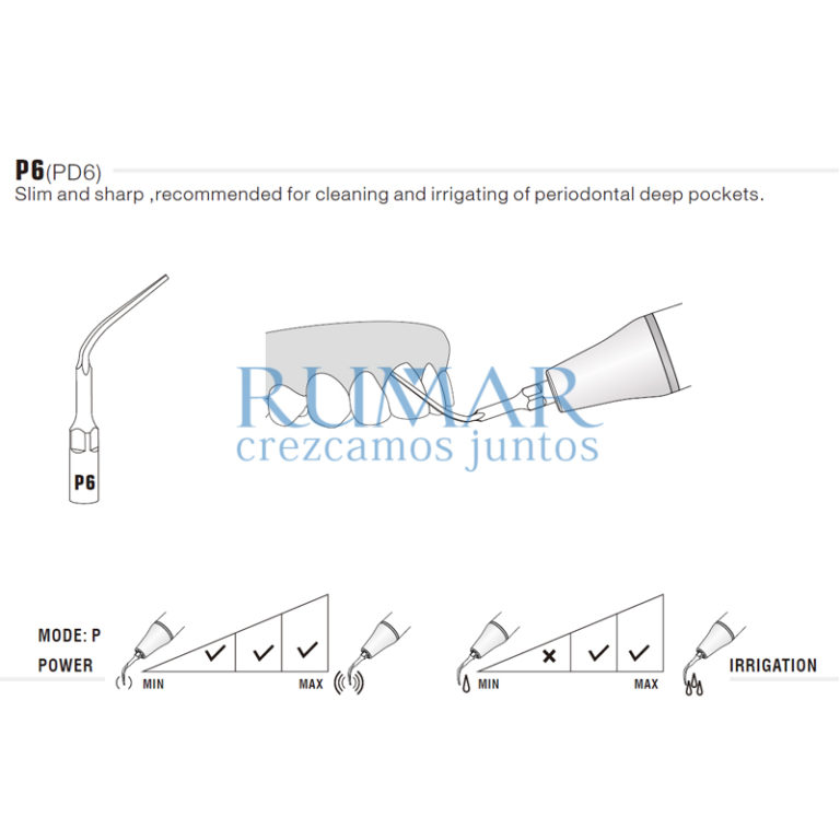 Woodpecker PD6 ultrasound tip Satelec compatible, Perio • RUMAR