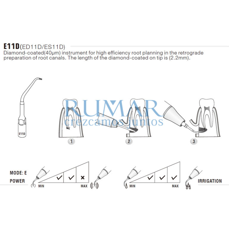 Woodpecker ED11 ultrasound tip compatible EMS, Endo • RUMAR