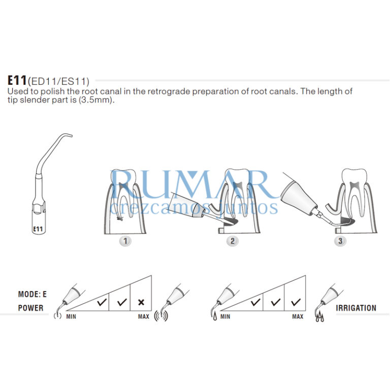 Ultrasonic tip ED11 compatible Satelec, Endo • RUMAR